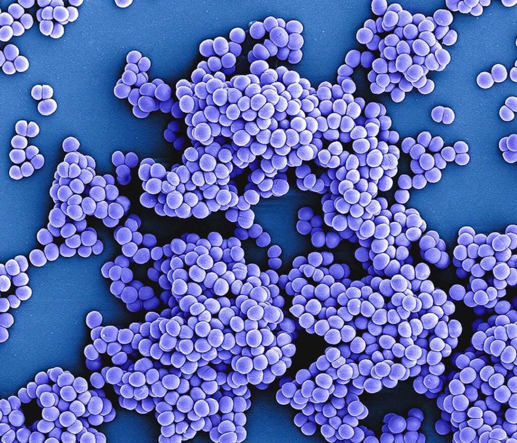 Comprendre le staphylocoque doré : symptômes, contagion et traitements ...